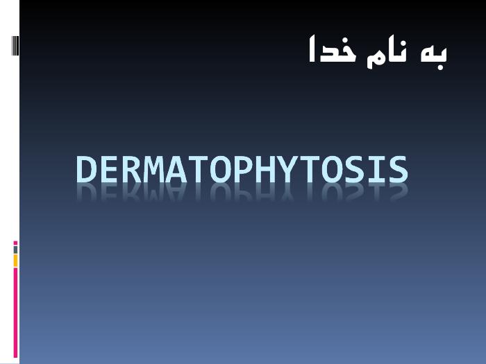 مرجع دانلود پاورپوینت | Dermatophytosis